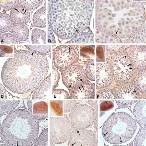 Photomicrographs Of Testicular Cross Sections Of 32dpp A To C 64dpp
