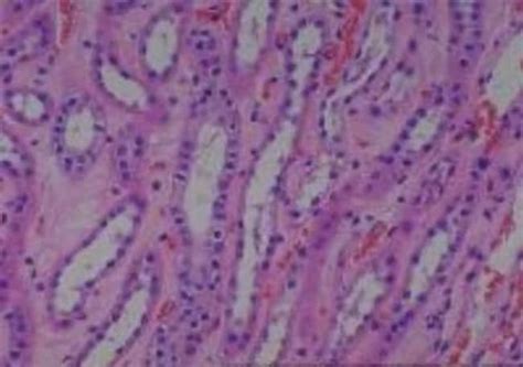Novus Biologicals™ Human Multi Tissue Tissue Microarray Cancer Human