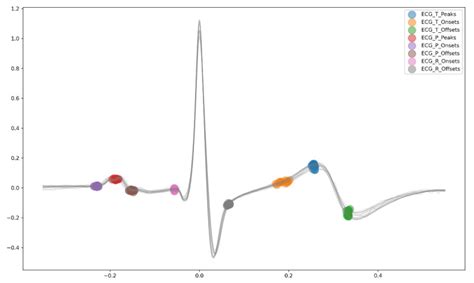 GitHub Asadian ECG Classification ECG Classification Intro Machine Learning Final Project