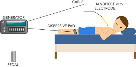 Electrosurgical System An Overview