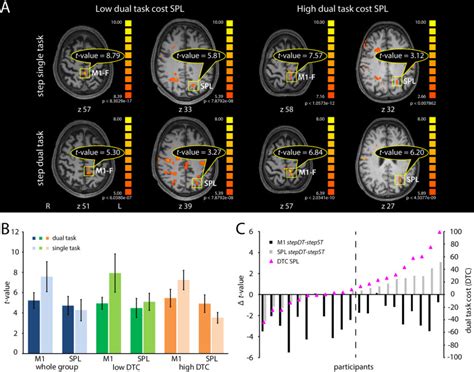 Neural Correlates Of Stepping In Healthy Elderly Parietal And
