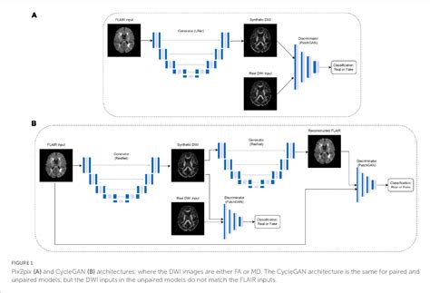 Table 1 From Synthesis Of Diffusion Weighted Mri Scalar Maps From Flair Volumes Using Generative