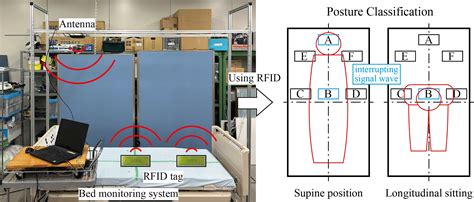 Posture Classification With A Bed Monitoring System Using Radio