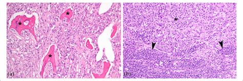 Oral Histiocytic Sarcoma In A Cat A Neoplastic Cells Invade Download Scientific Diagram