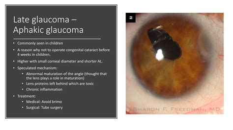 Glaucoma Post Cataract Surgery Pdf