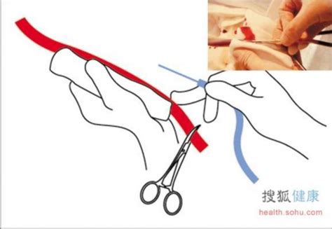 揭秘脐带血采集全过程文章信息行业动态新闻中心江苏省血液中心 Powered By Stpass