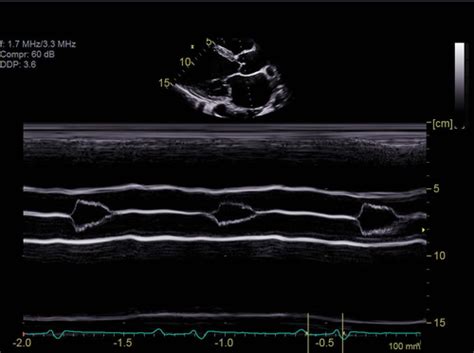 Echo Quiz 10 Flashcards Quizlet