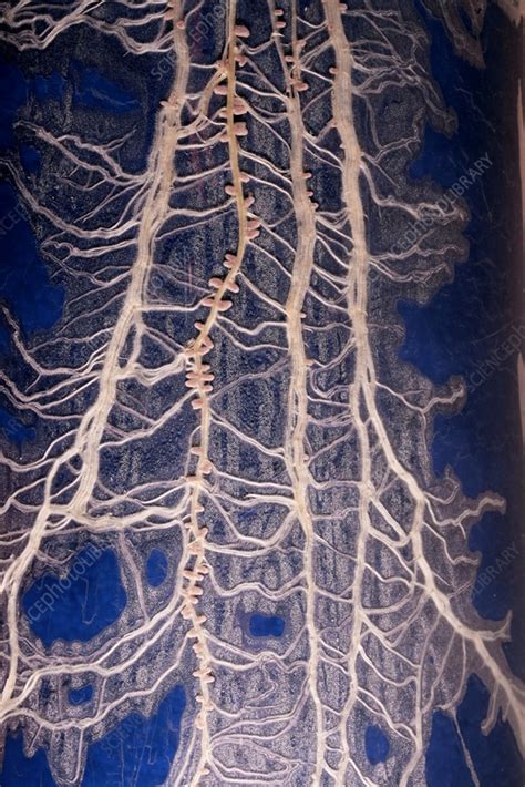 Plant Roots With Root Nodules Stock Image C0599742 Science Photo