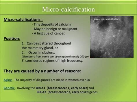 Microcalcification Enhancement In Digital Mammogram