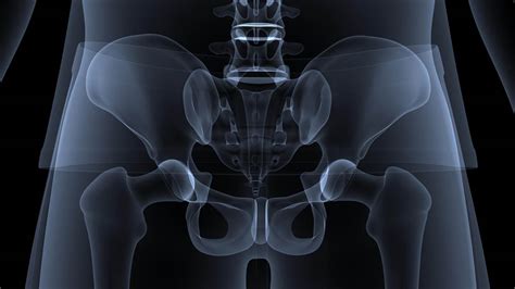 Pelvic Fracture Types Causes Symptoms And Treatments