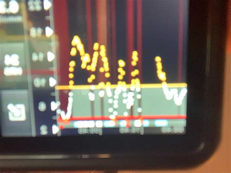 Control Iq Not Keeping In Range Rtandemdiabetes