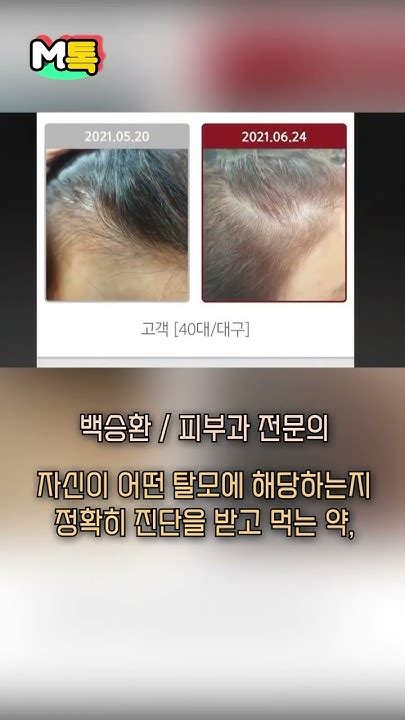 탈모 예방·치료 샴푸 없다 허위 광고 무더기 적발 [shorts] Youtube