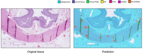 Artifact Detection In Digitized Histopathology Images Computational Pathology Group