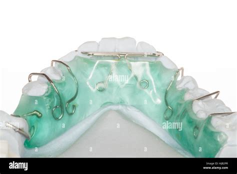 Isolated Teeth Dentist Pine Tooth Tooth Space Bracket Caries