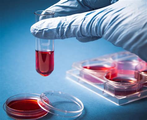 Forensic Toxicology Forensic Science Institute