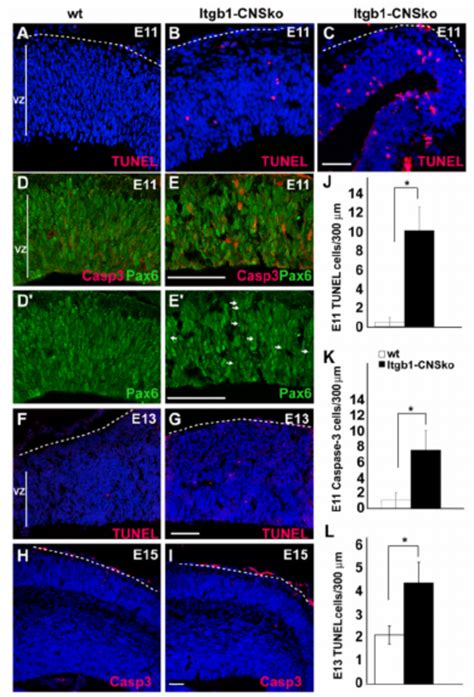 Increased Apoptosis Of Rgc Cells Download Scientific Diagram