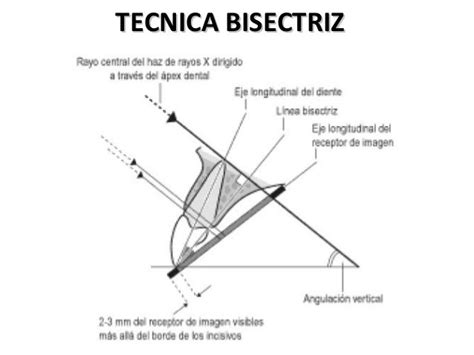 Tecnica De La Bisectriz