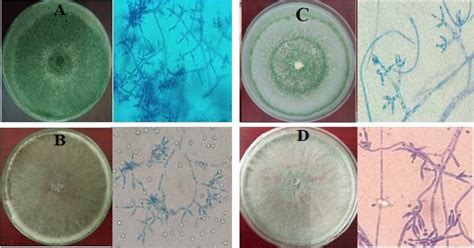Macroscopic And Microscopic Appearance Of Colonies Representing Download Scientific Diagram