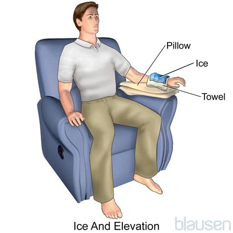 Overview Of Sports Injuries Injuries And Poisoning Msd Manual Consumer Version Sports
