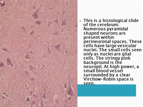Cerebrum Pyramidal Cells Histology