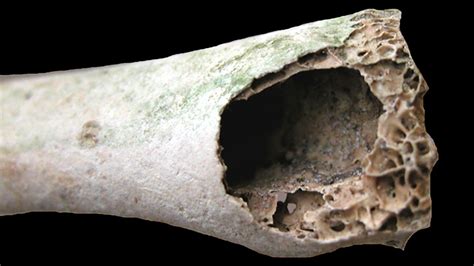 Gravity Bone Explained Virginretpa