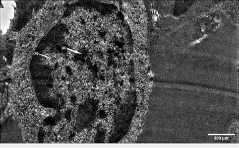 Scanning Electron Microscopy Showing Intercellular Spaces Between Download Scientific Diagram