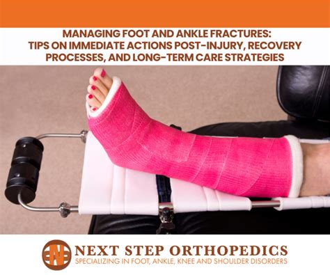 Managing Foot And Ankle Fractures Tips On Immediate Actions Post