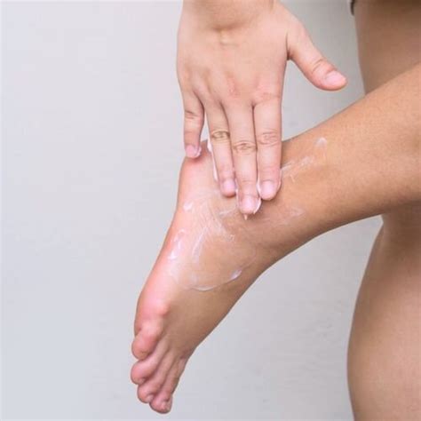 5 Reasons Why Your Feet May Be Dry — Precision Foot And Ankle Centers