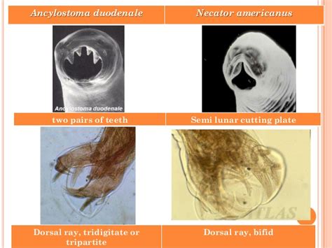 Lecture Notes In Medical Technology Lecture 4 The Hookworms