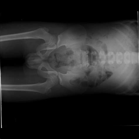 Yolo Fracture Detection Object Detection Dataset By Cvpr