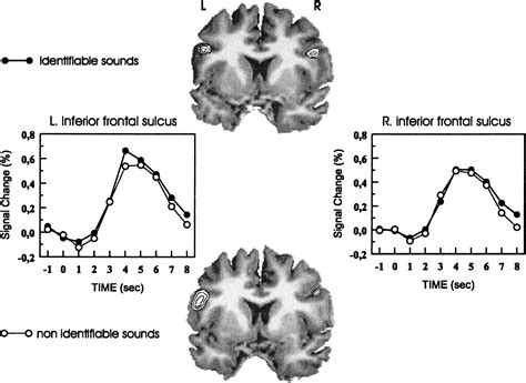 Functional Asymmetry Of Human Prefrontal Cortex Encoding And Retrieval
