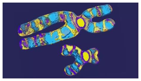 One In 500 Men May Carry An Extra Sex Chromosome Most Without Knowing It Science