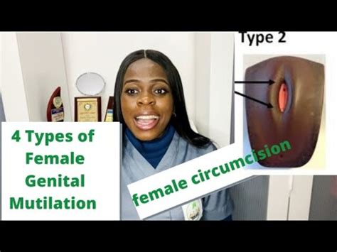 Types Of Female Circumcision