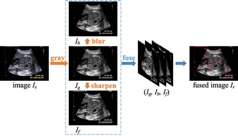 Figure 1 From Fetal Ultrasound Standard Plane Detection With Coarse To Fine Multi Task Learning