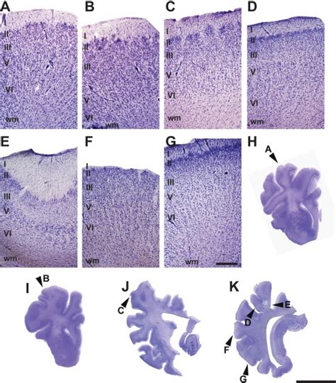 Photomicrographs Of A Golgi Impregnated Large Magnopyramidal Neuron Of Download Scientific