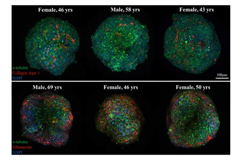 Archives Des News Predictcan