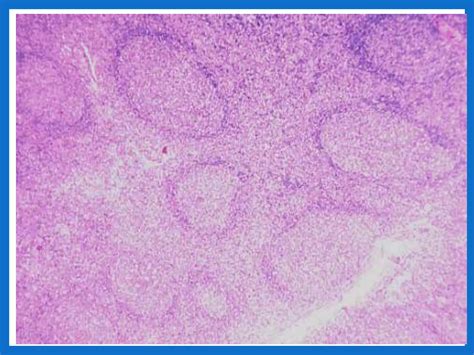 Histology And Pathology Of Lymph Nodes Pptx