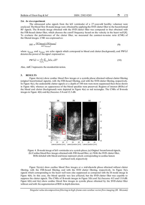 Singular Value Decomposition Filtering In High Frame Rate Cardiac Vector Flow Imaging Pdf