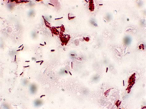 Modified Acid Fast Staining Of The Pathogen From Blood Cultures At The