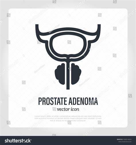 Prostate Adenoma Benign Prostatic Hyperplasia Thin Stock Vector