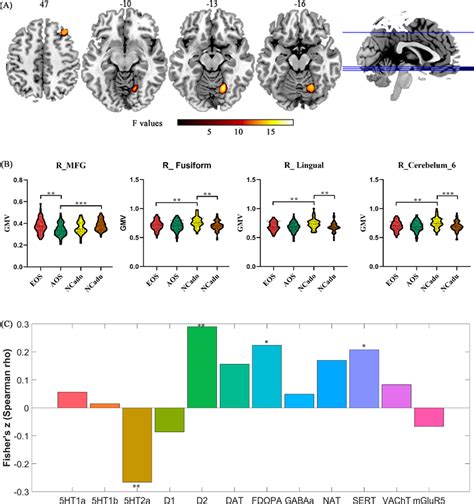 Gray Matter Alterations Associated With The Interaction Of Download Scientific Diagram