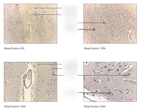 Diagram Of Cerebrum Histology Quizlet