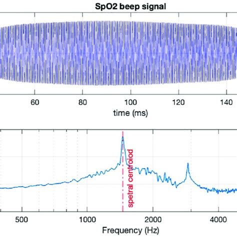 Spo2 Generic Beep Recorded Signal Representation In Time Domain Top Download Scientific