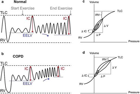 Flow Volume Loops At Rest And Exercise Tidal Flow Volume Loops