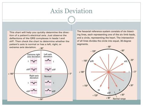 Ppt Cardiovascular Monitoring Electrocardiogram Powerpoint