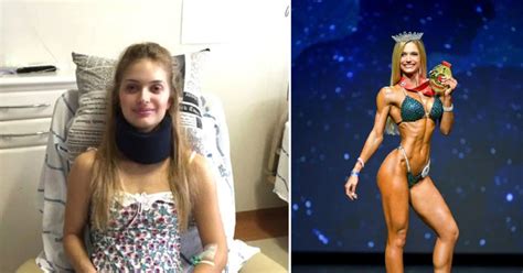 하반신 마비 경고받았던 브라질 여성 보디빌딩 대회 1등 쾌거 어떻게 된 사연