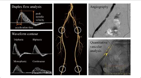 Lower Extremity Arterial Flow