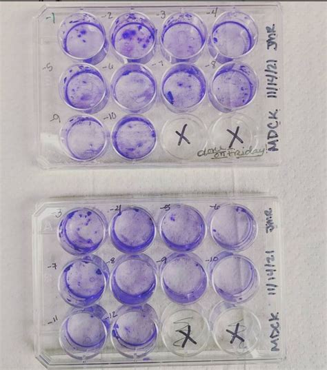 159 Questions With Answers In Plaque Assay Scientific Method