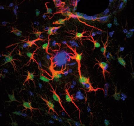François Jacob Institute of biology Reactive astrocytes in neurodegenerative diseases