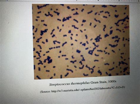 Proteus Vulgaris Gram Stain 1000x Proteus Vulgaris Gram Stain 1000x